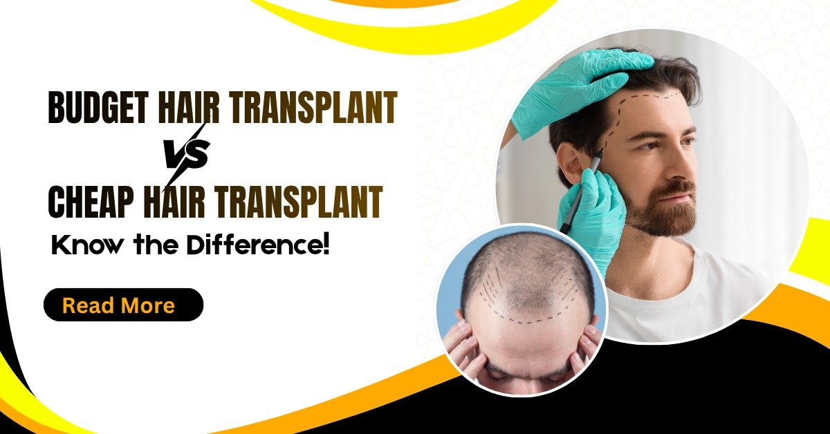 Budget Hair Transplant vs. Cheap Hair Transplant